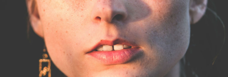 What is Open Mouth Posture? – Maple Dental Hygeine